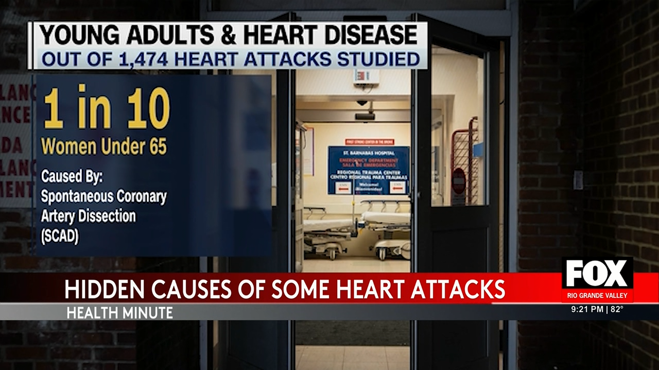 Heart Attacks In Young Adults: New Study Unveils Hidden Causes - Fox ...