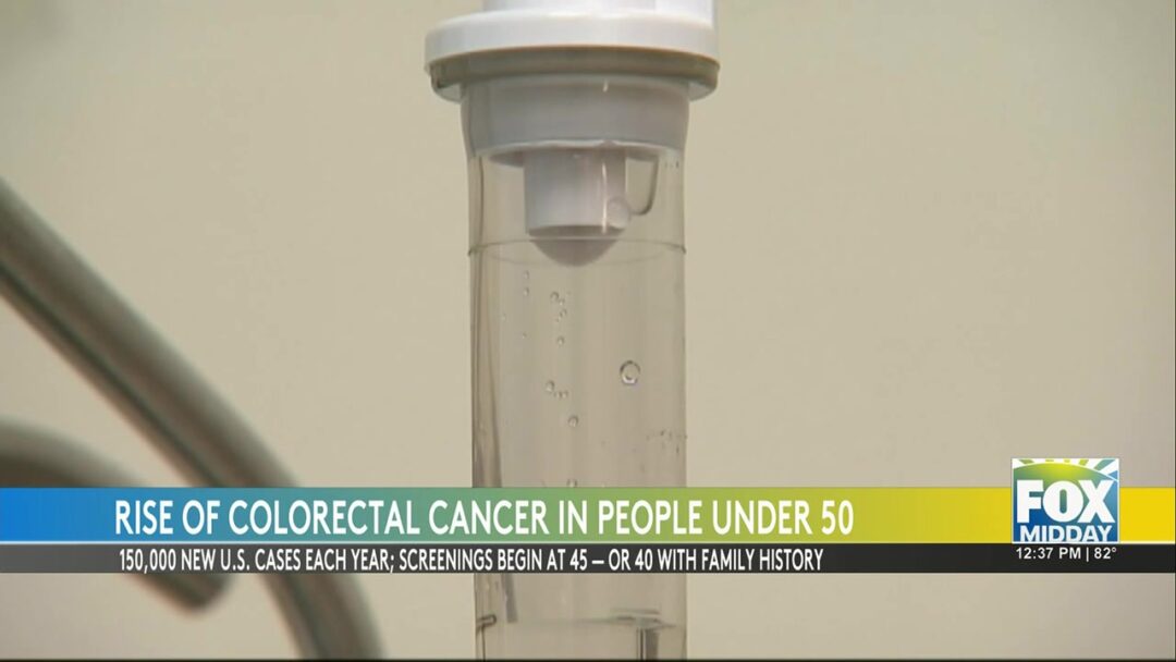 Rising Colon Cancer Rates Among Young Americans